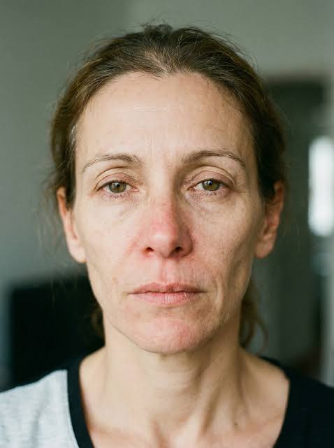 Ozempic Face: Por Qué Ocurre y Cómo Recuperar la Firmeza y Volumen del ...